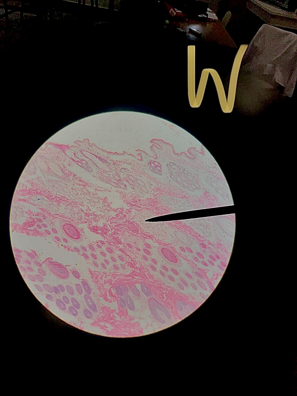 Removing dust spots from microscope photo - Adobe Community - 13122158